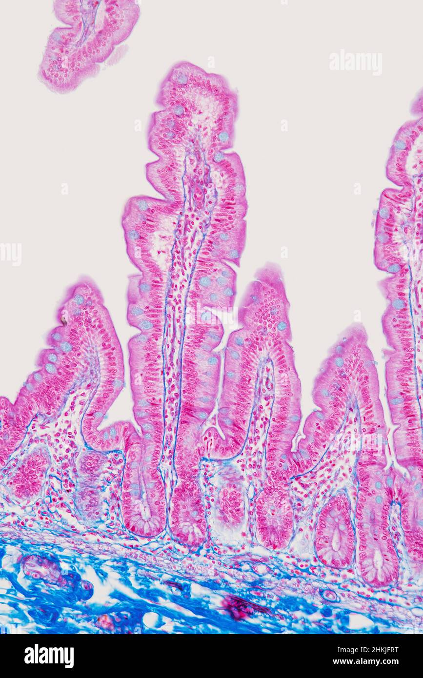 Small intestine, light micrograph Stock Photo - Alamy