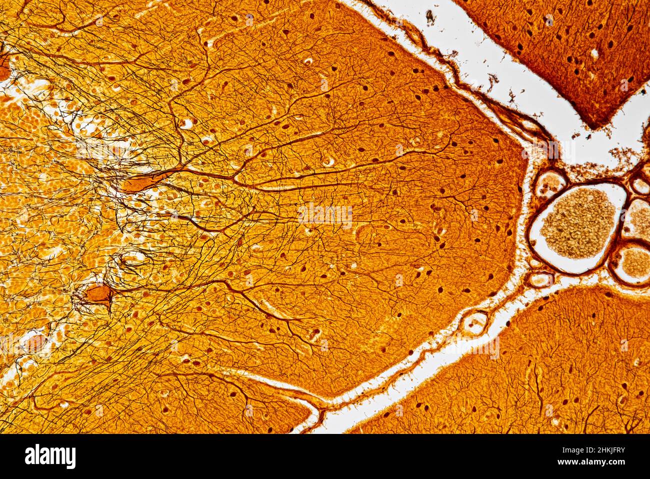 Cerebellum tissue, light micrograph Stock Photo - Alamy
