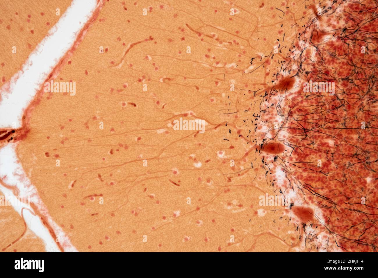 Cerebellum tissue, light micrograph Stock Photo - Alamy
