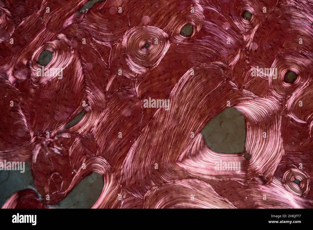 Bone tissue, light micrograph Stock Photo - Alamy