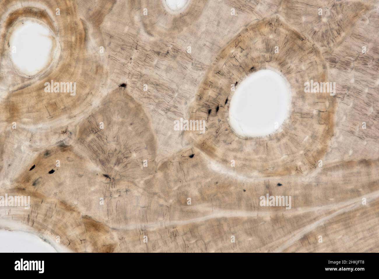 Compact bone, light micrograph Stock Photo - Alamy