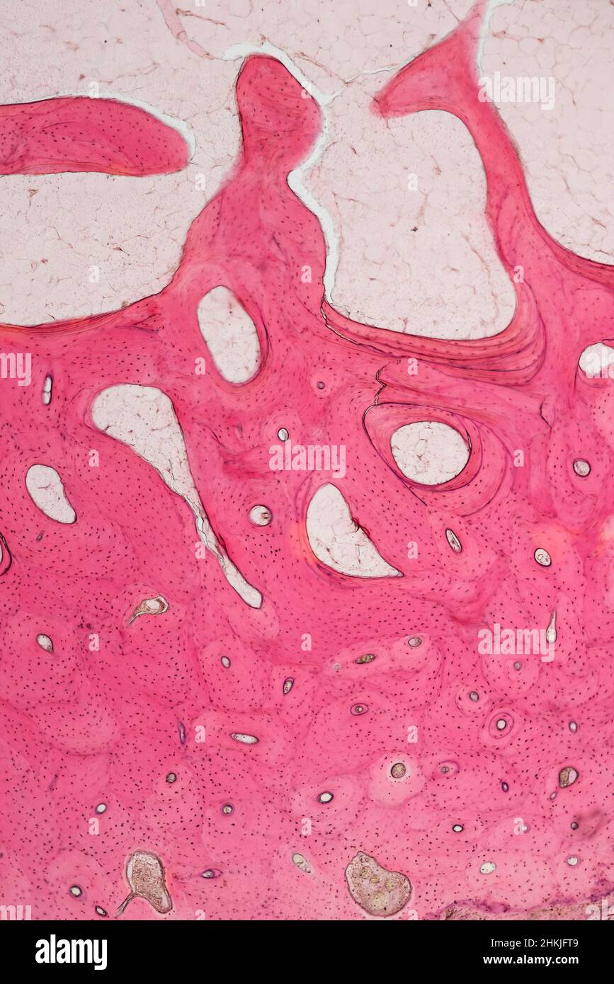 Bone tissue, light micrograph Stock Photo - Alamy