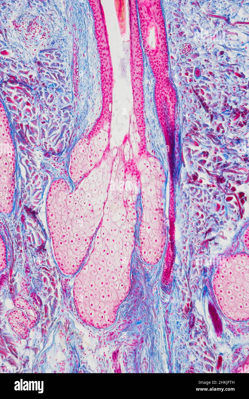 Hair follicle sebaceous gland, light micrograph Stock Photo - Alamy