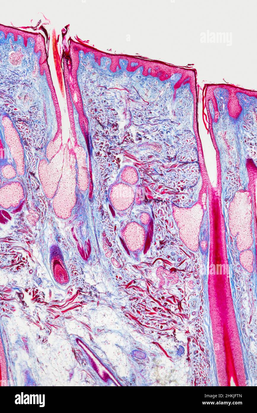 Human scalp, light micrograph Stock Photo - Alamy