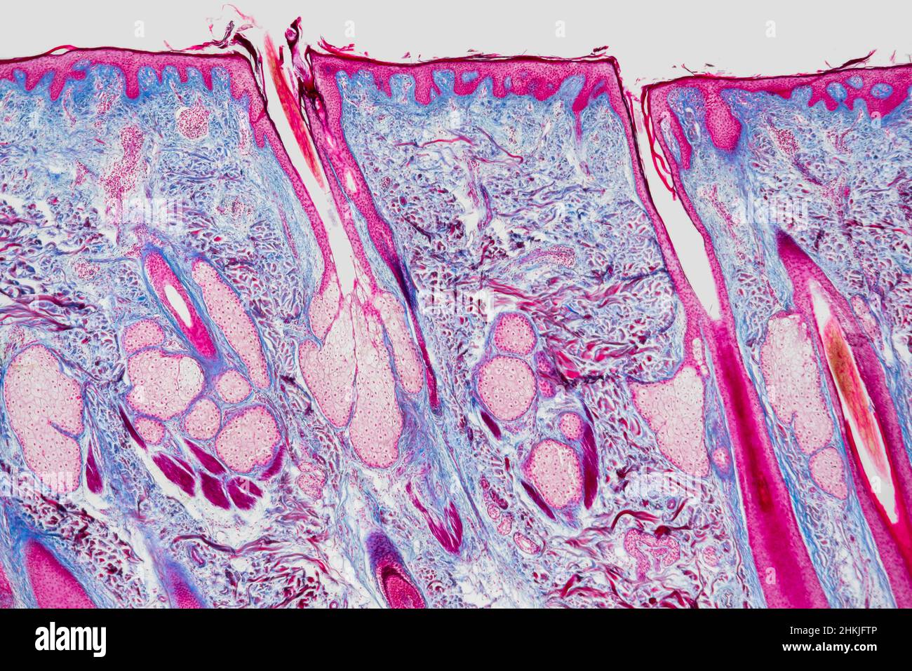 Human scalp, light micrograph Stock Photo - Alamy