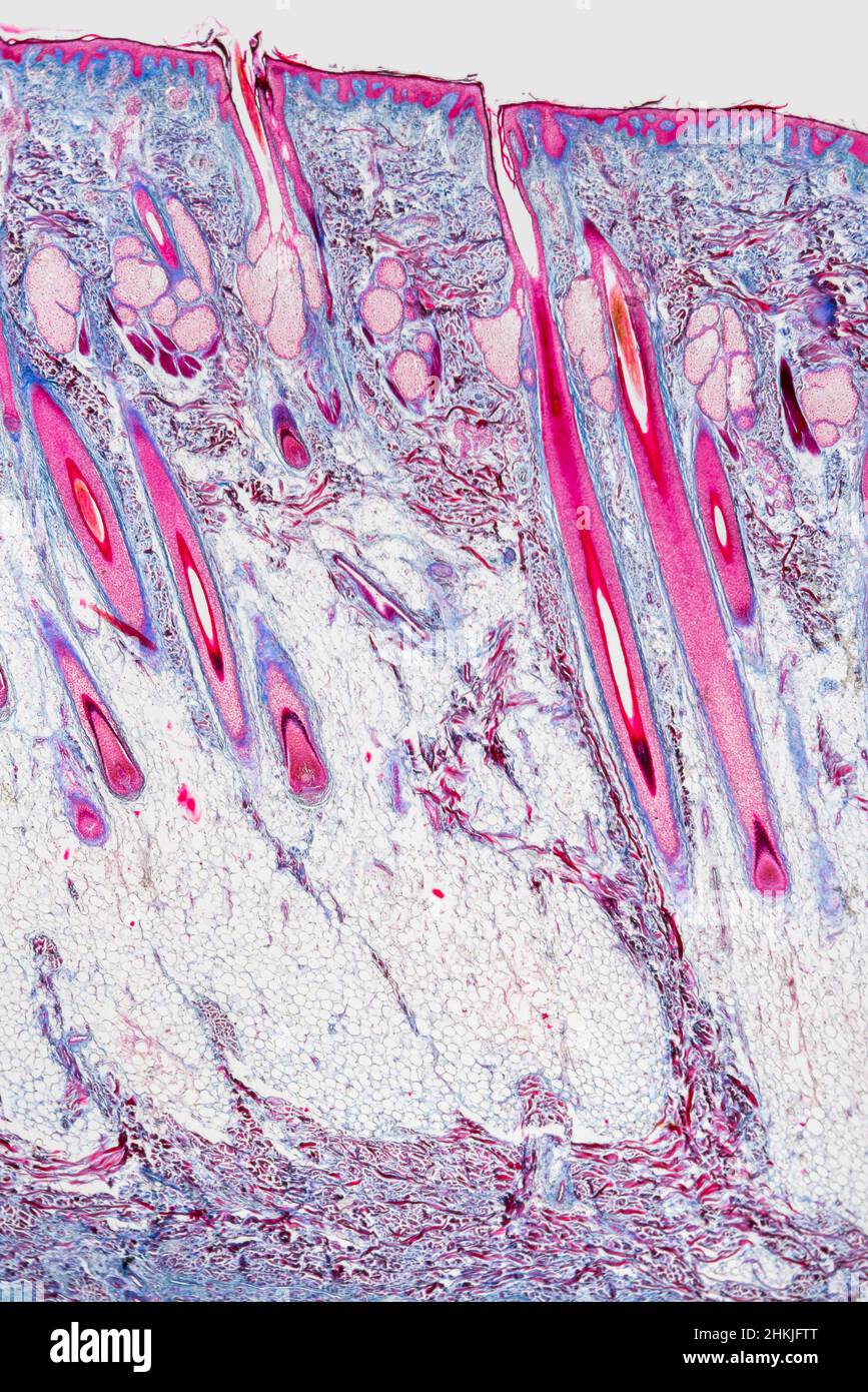 Human scalp, light micrograph Stock Photo - Alamy