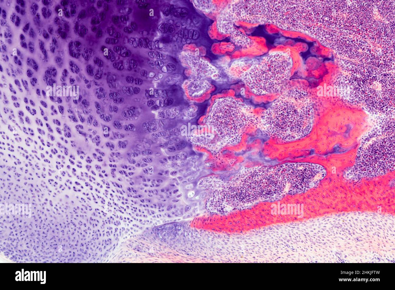 Foetal finger bone, light micrograph Stock Photo - Alamy