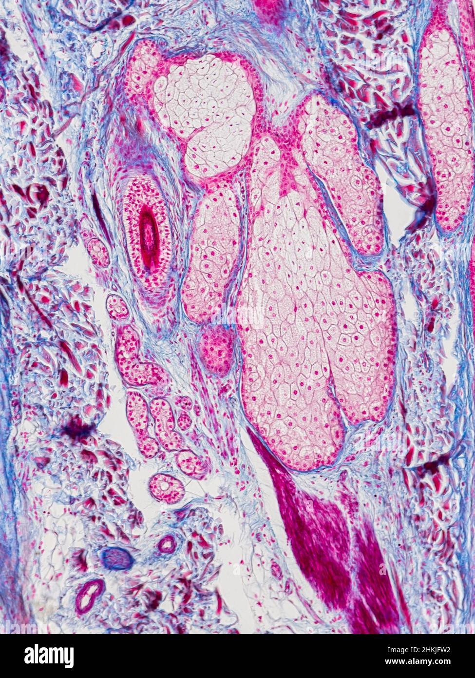 Hair follicle sebaceous gland, light micrograph Stock Photo - Alamy