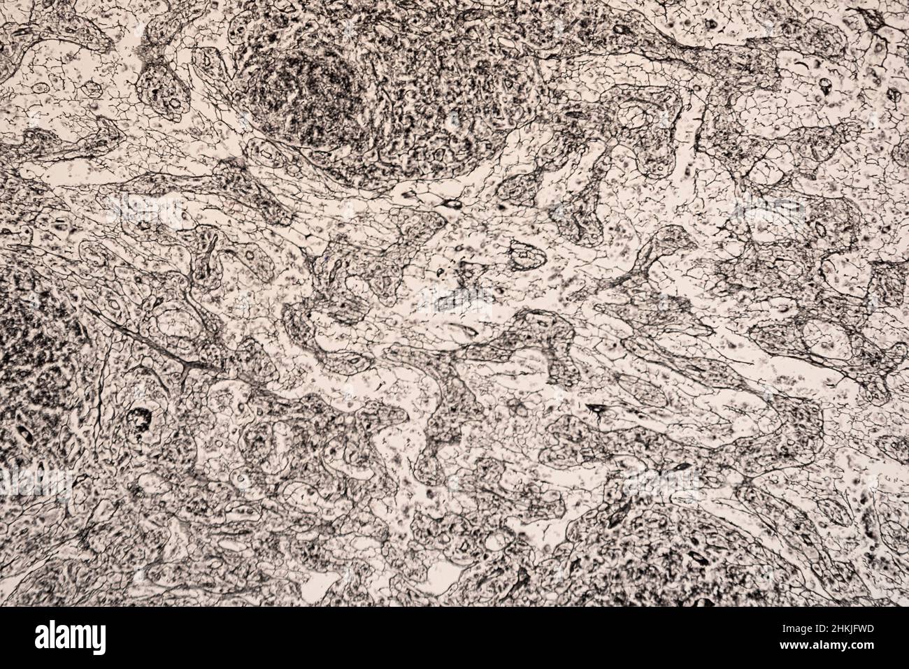 Lymph node, light micrograph Stock Photo - Alamy