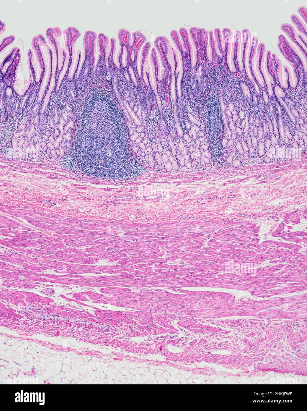 Stomach lining, light micrograph Stock Photo - Alamy