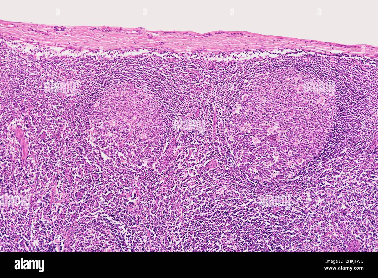 Lymph node, light micrograph Stock Photo - Alamy