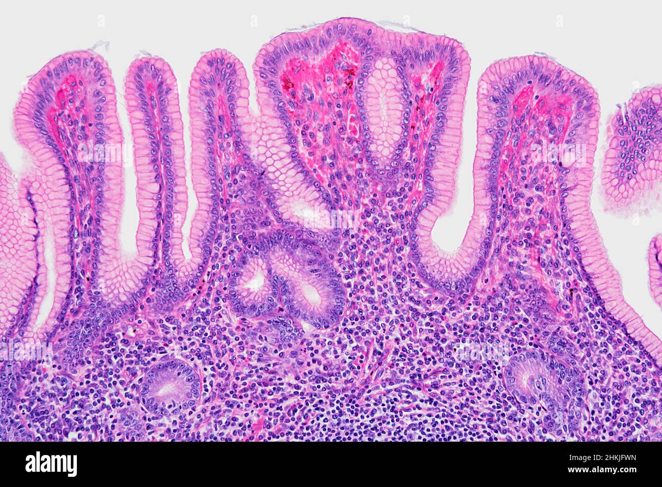 Stomach lining, light micrograph Stock Photo - Alamy