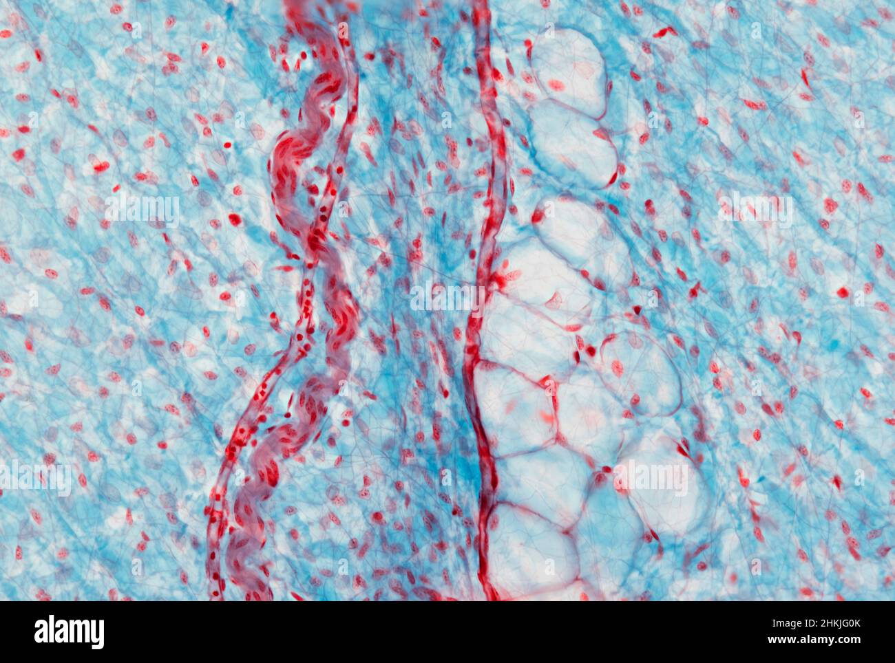 Mesentery, light micrograph Stock Photo - Alamy