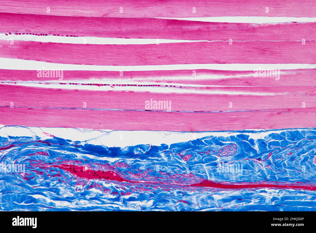 Skeletal muscle fibres, light micrograph Stock Photo - Alamy Skeletal muscle fibres, light micrograph Stock Photo - Alamy