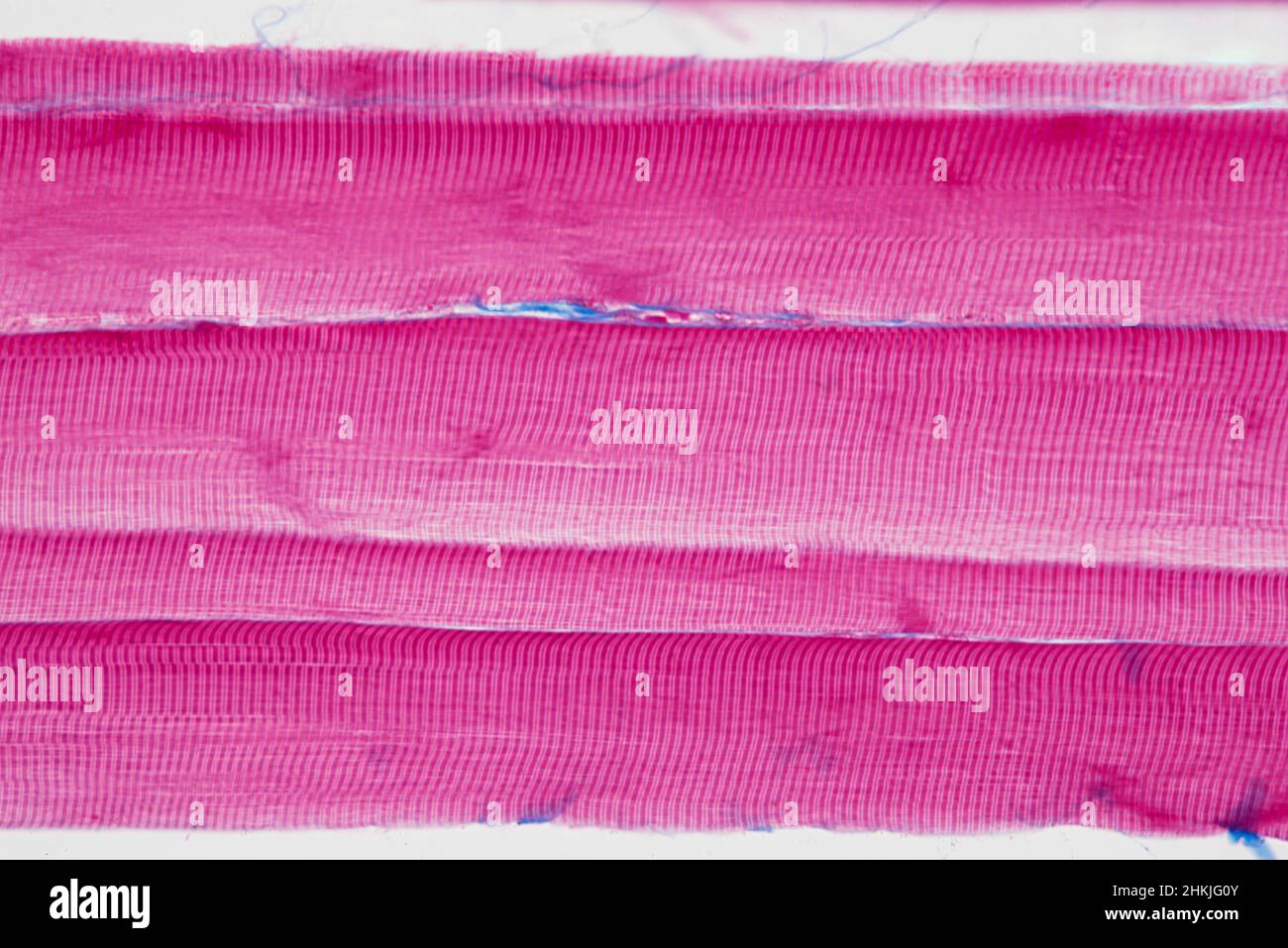 Skeletal muscle fibres, light micrograph Stock Photo - Alamy Skeletal muscle fibres, light micrograph Stock Photo - Alamy
