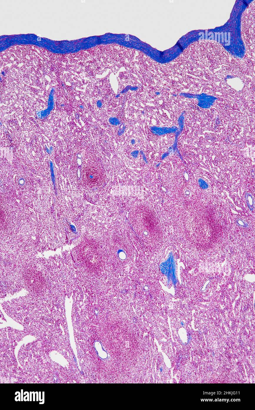 Spleen, light micrograph Stock Photo - Alamy