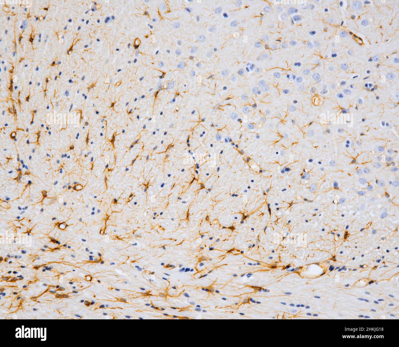 Glial cells, light micrograph Stock Photo - Alamy