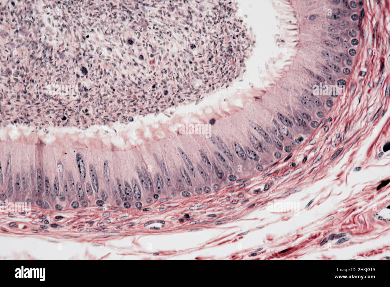 Epididymis, light micrograph Stock Photo - Alamy