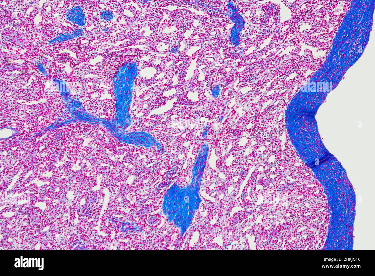 Spleen, light micrograph Stock Photo - Alamy
