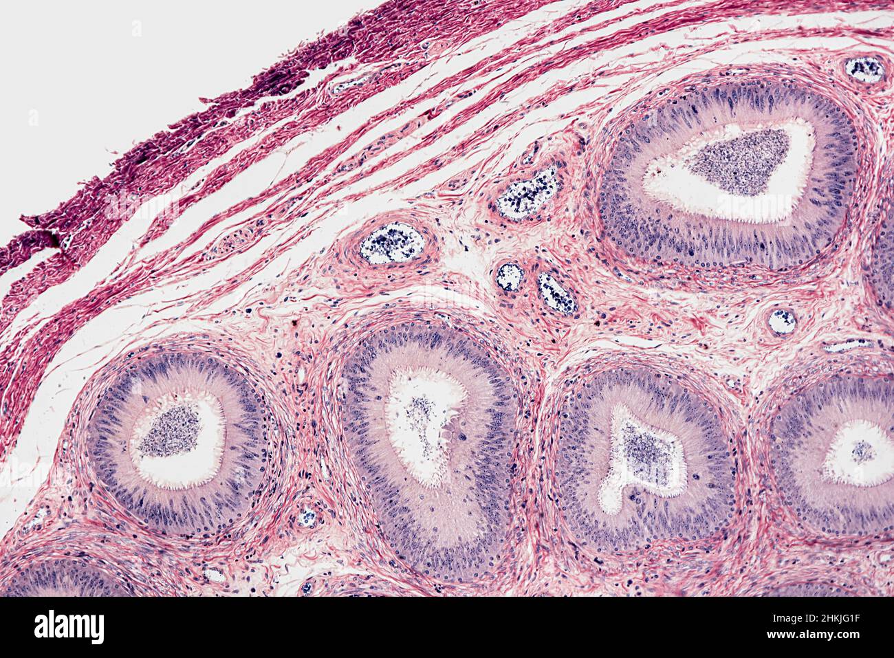 Epididymis, light micrograph Stock Photo - Alamy