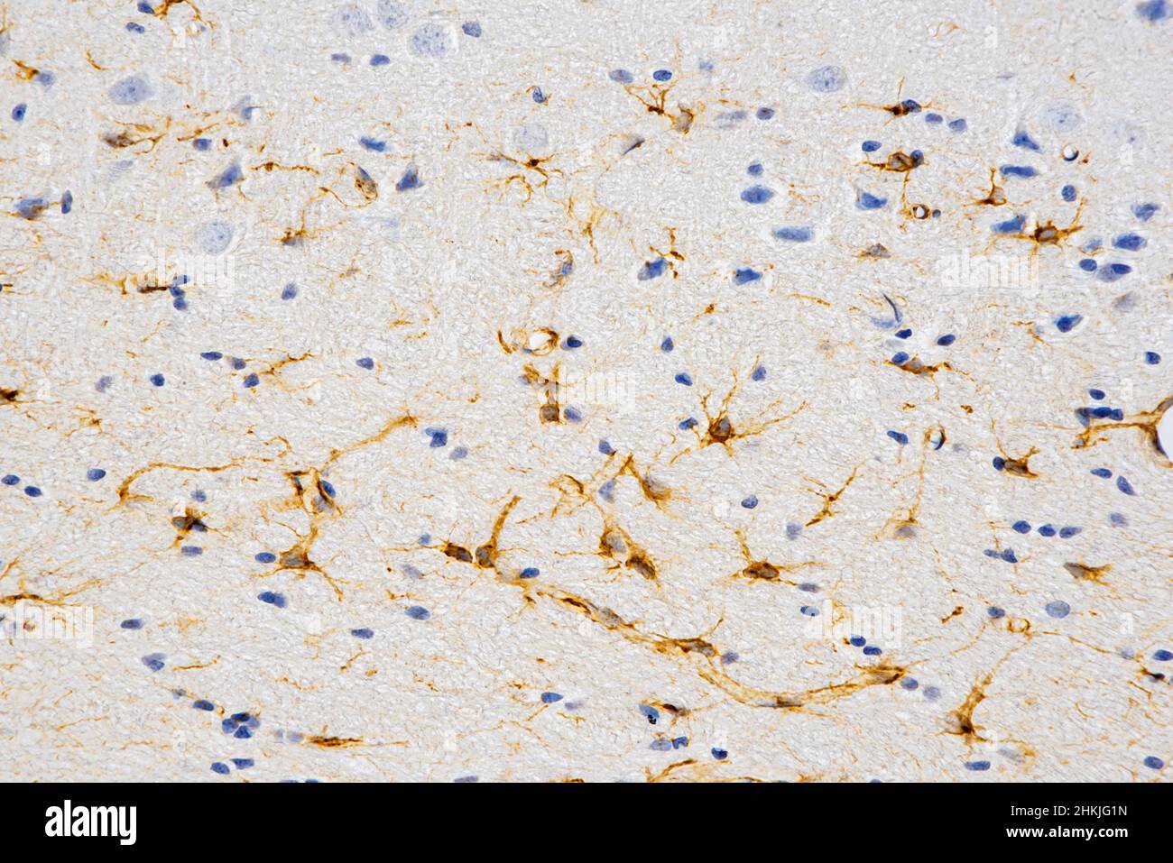 Glial cells, light micrograph Stock Photo - Alamy