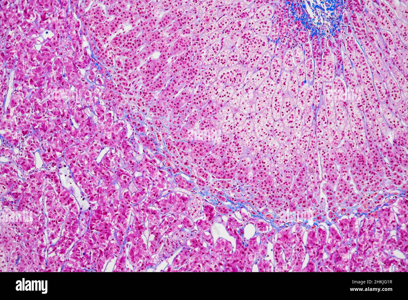 Adrenal gland, light micrograph Stock Photo - Alamy