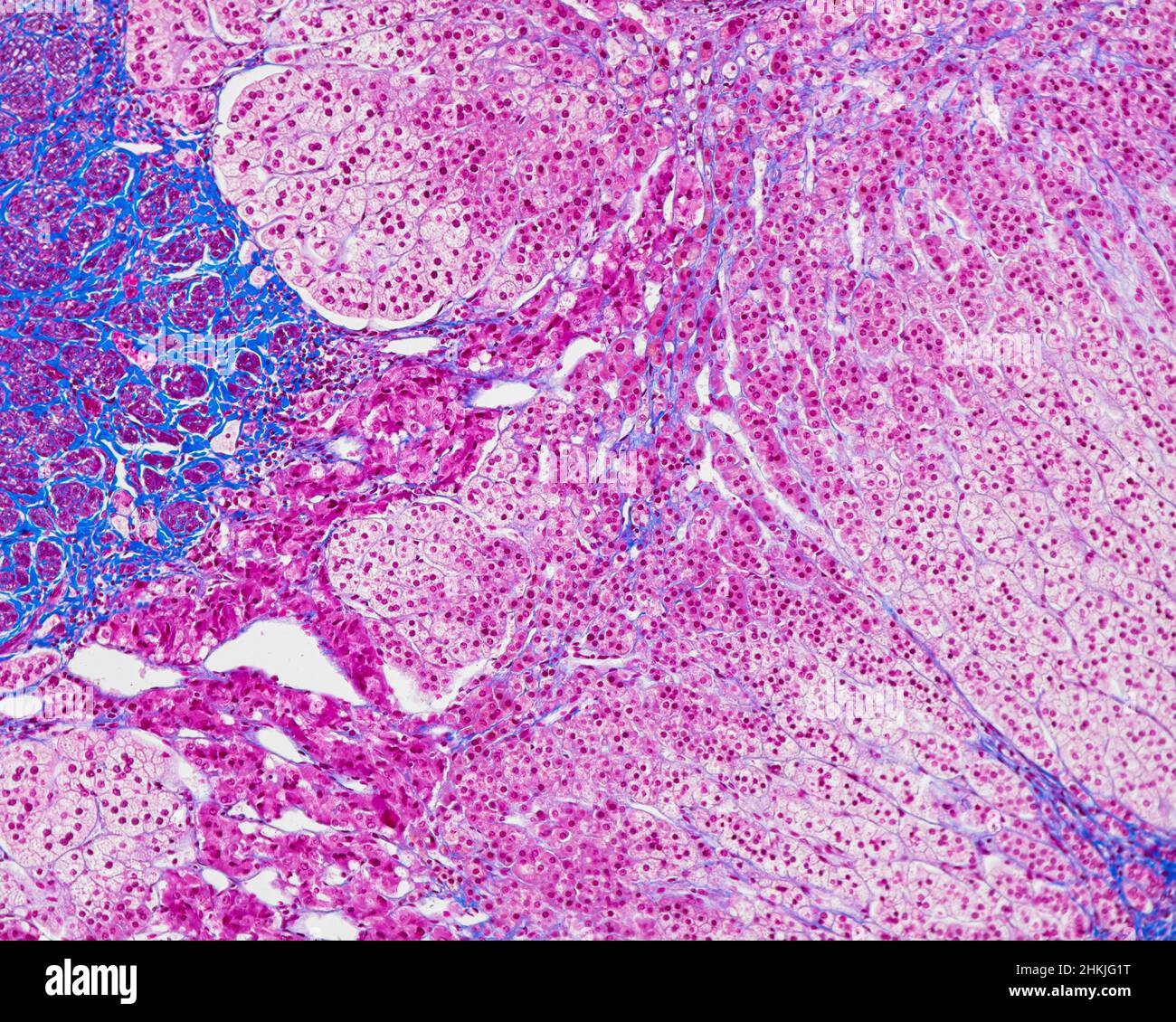 Adrenal gland, light micrograph Stock Photo - Alamy