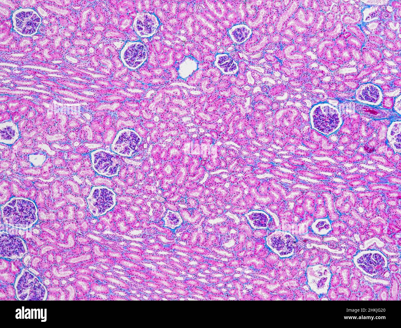 Kidney, light micrograph Stock Photo - Alamy