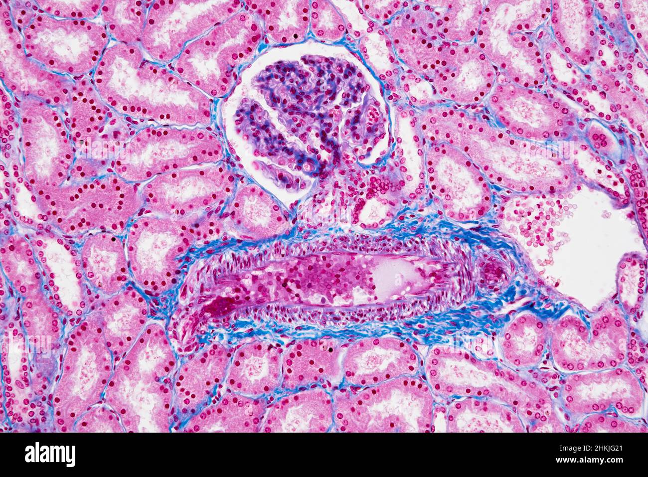 Kidney, light micrograph Stock Photo - Alamy