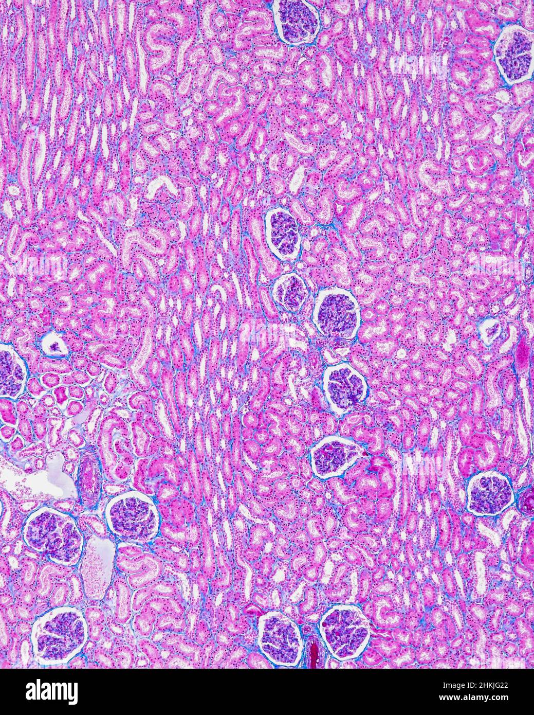 Kidney, light micrograph Stock Photo - Alamy