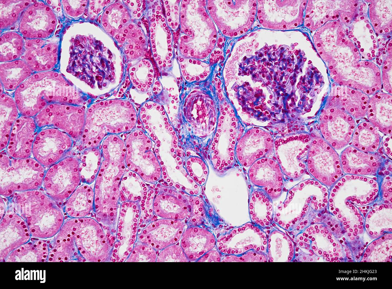 Kidney, light micrograph Stock Photo - Alamy