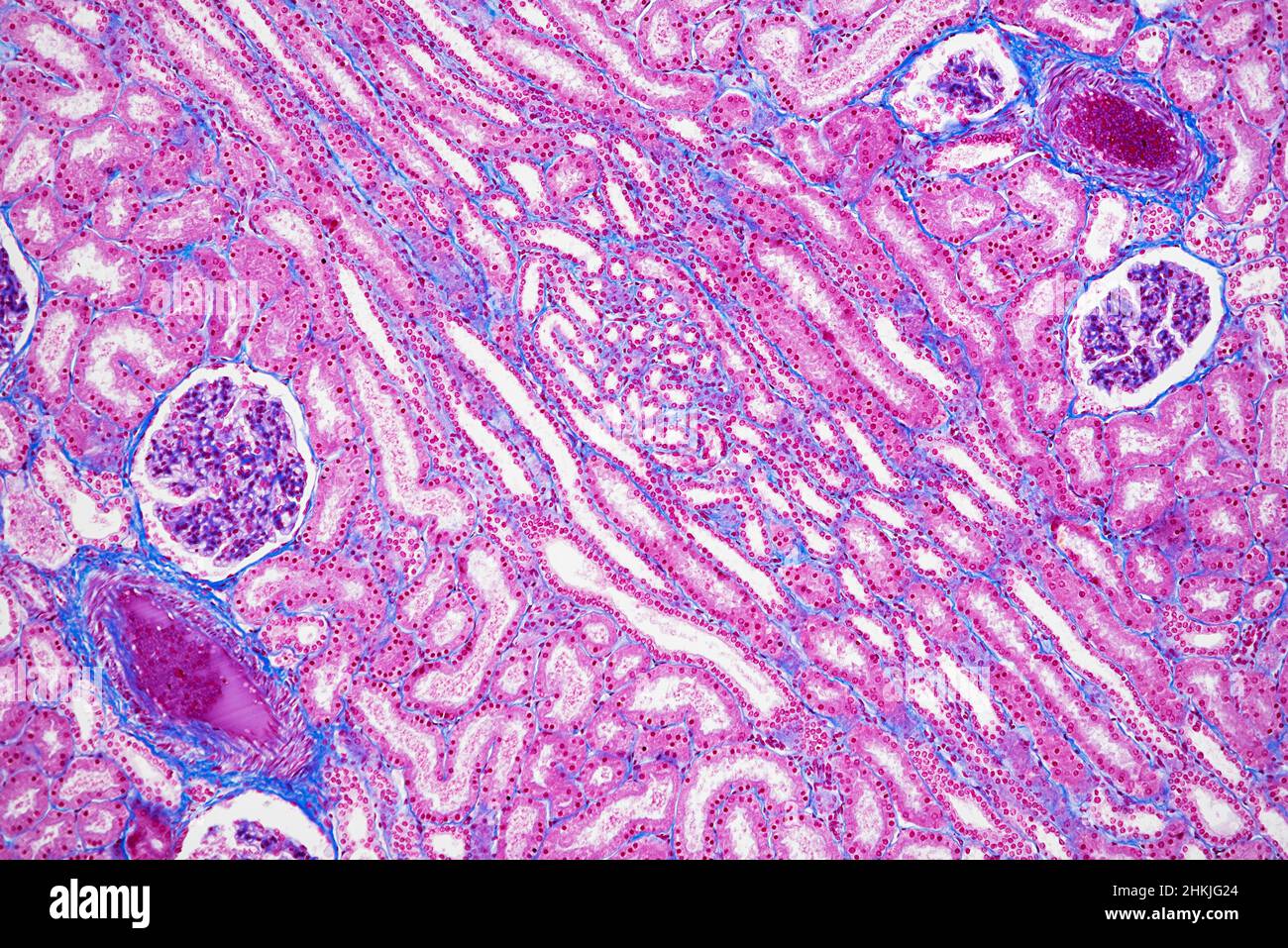 Kidney, light micrograph Stock Photo - Alamy