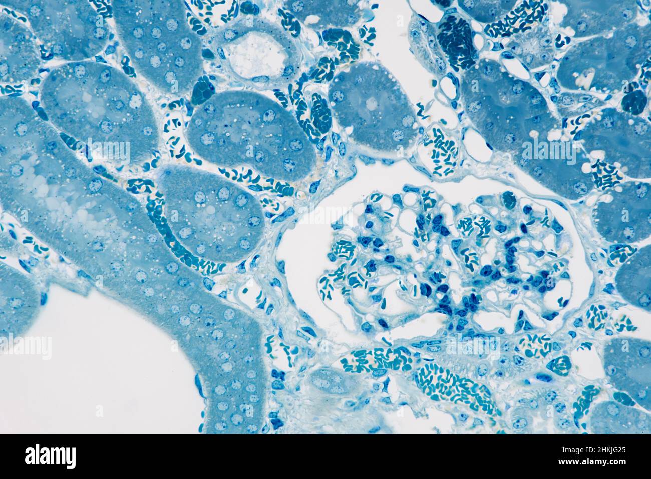 Kidney, light micrograph Stock Photo - Alamy