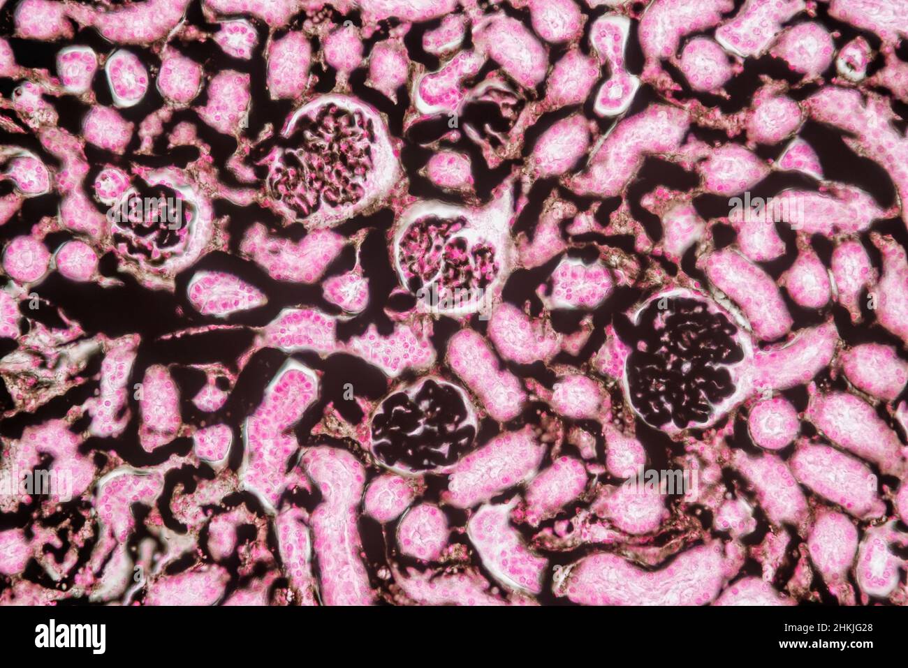 Kidney, light micrograph Stock Photo - Alamy