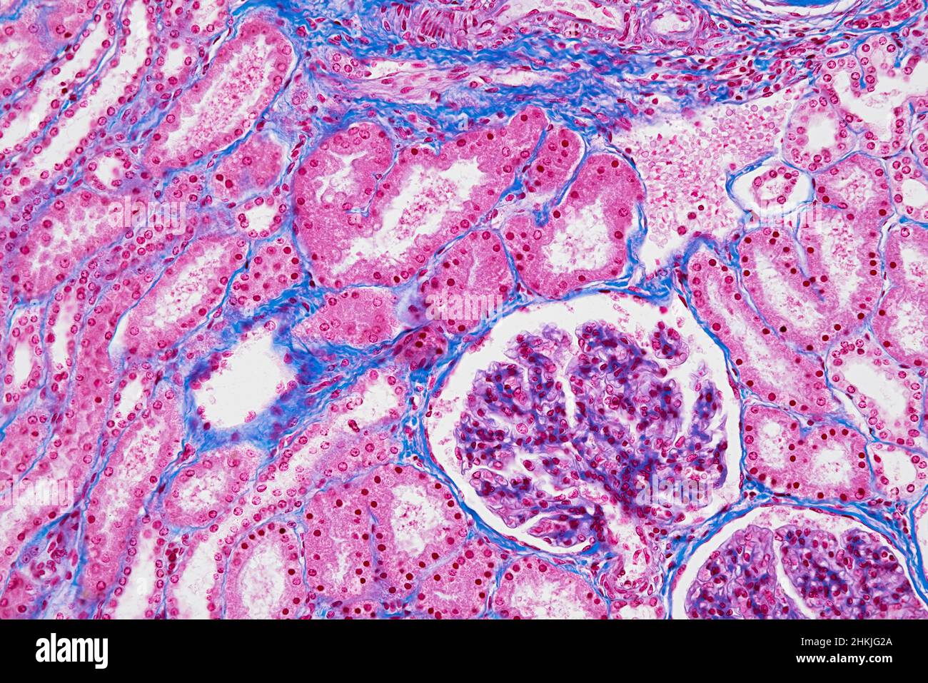 Kidney, light micrograph Stock Photo - Alamy