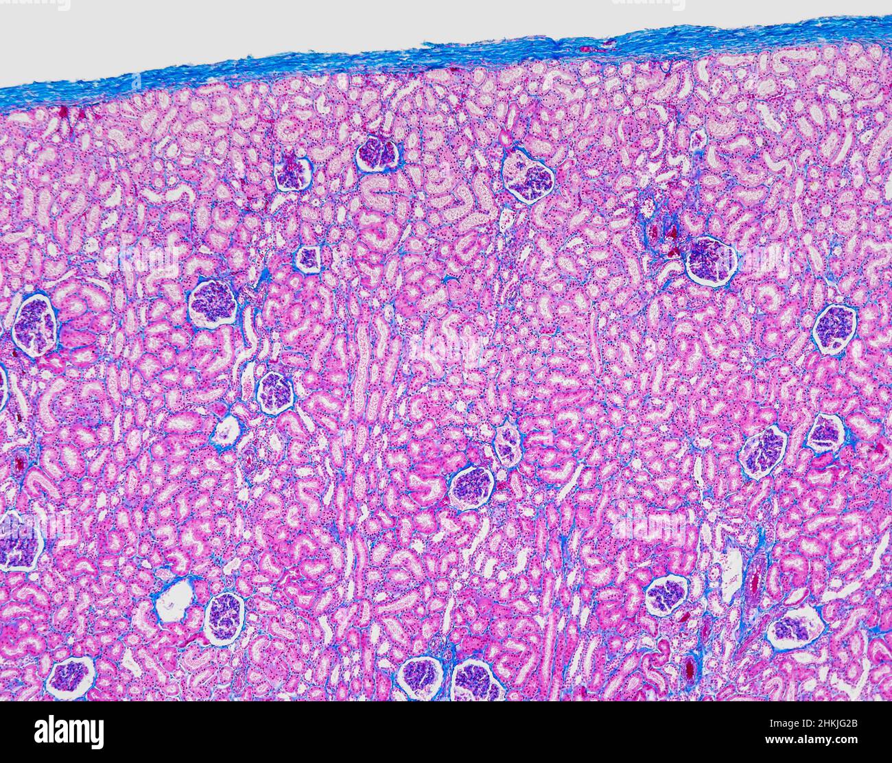 Kidney, light micrograph Stock Photo - Alamy