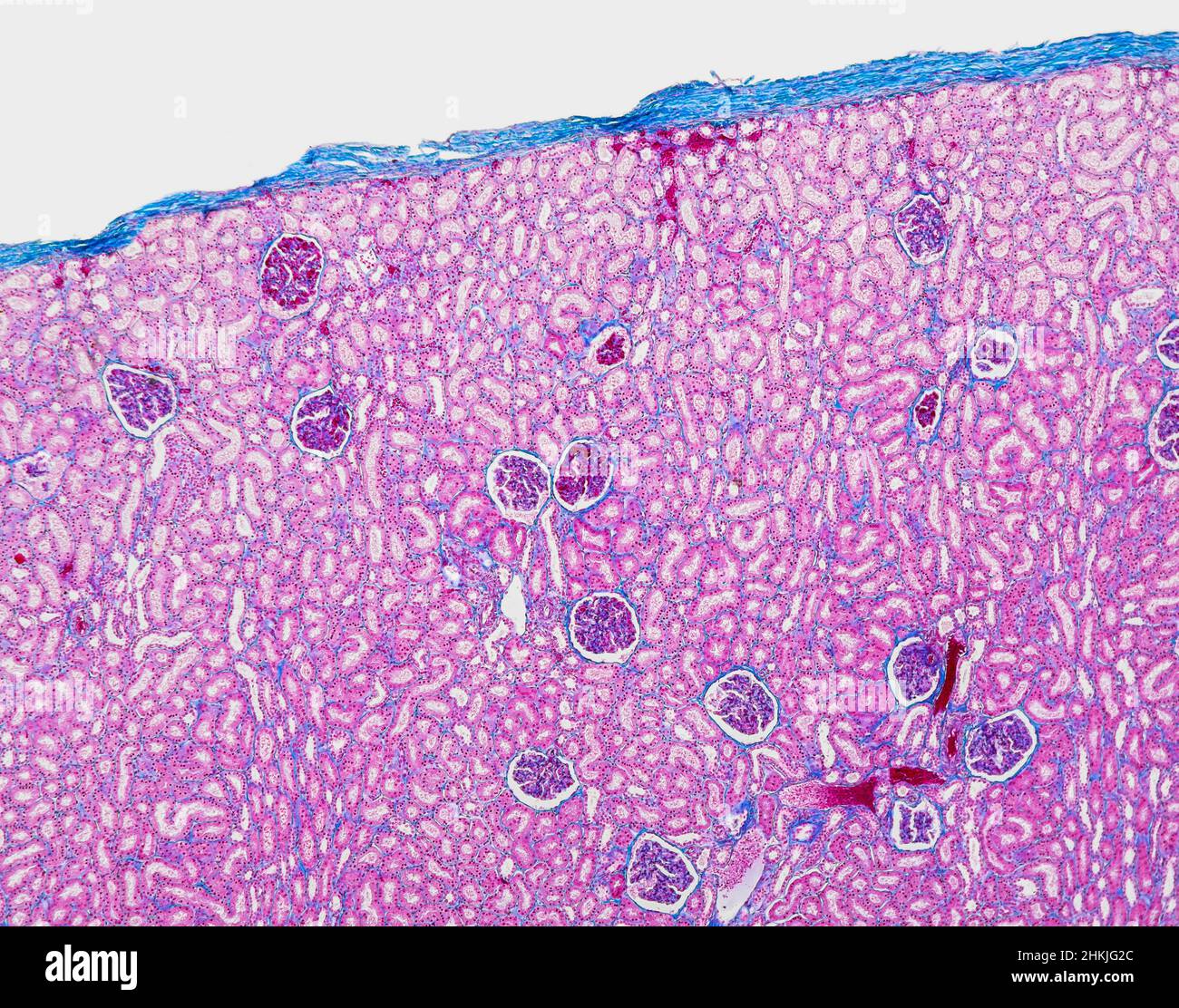 Kidney, light micrograph Stock Photo - Alamy