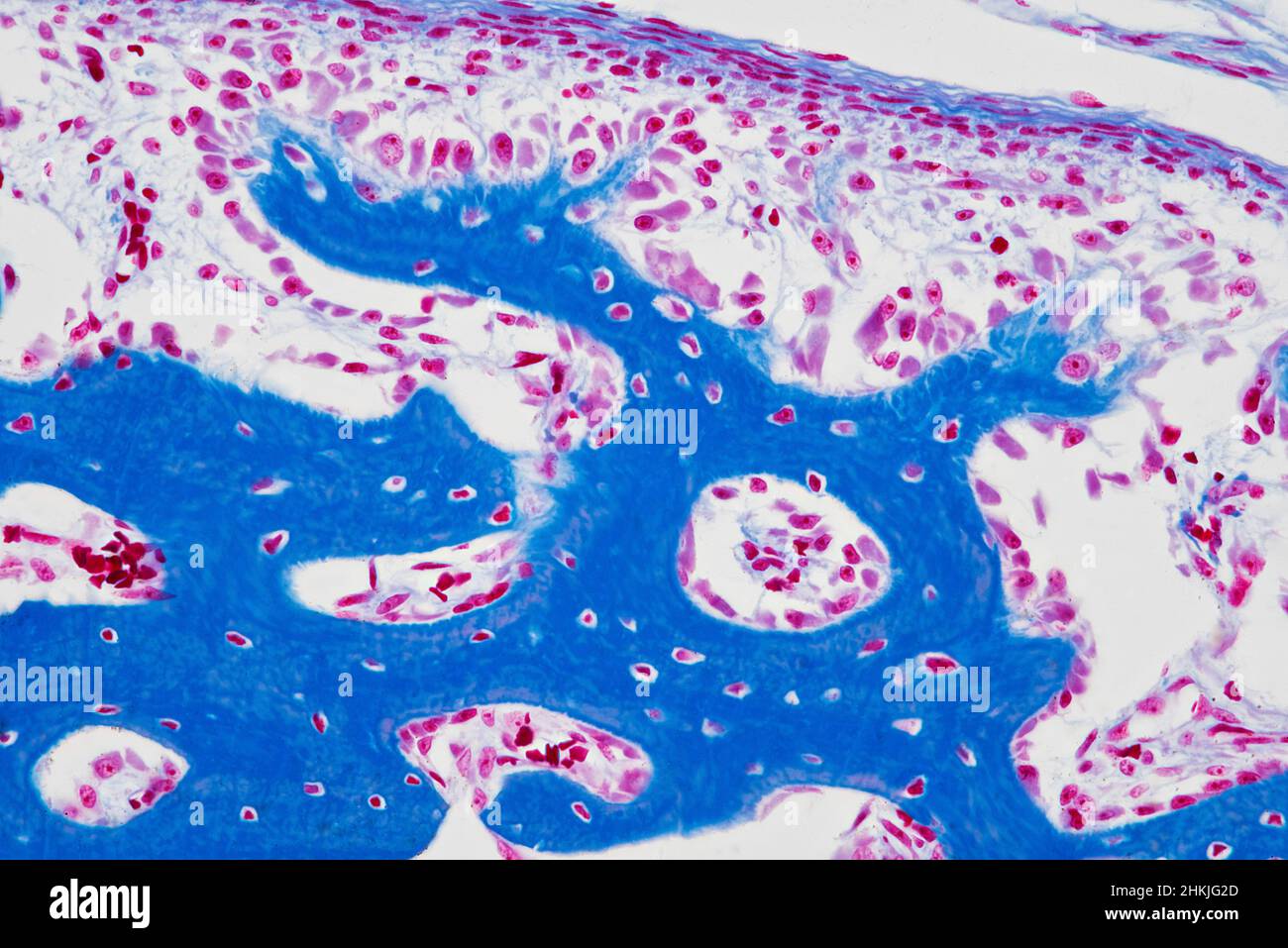 Bone formation, light micrograph Stock Photo - Alamy