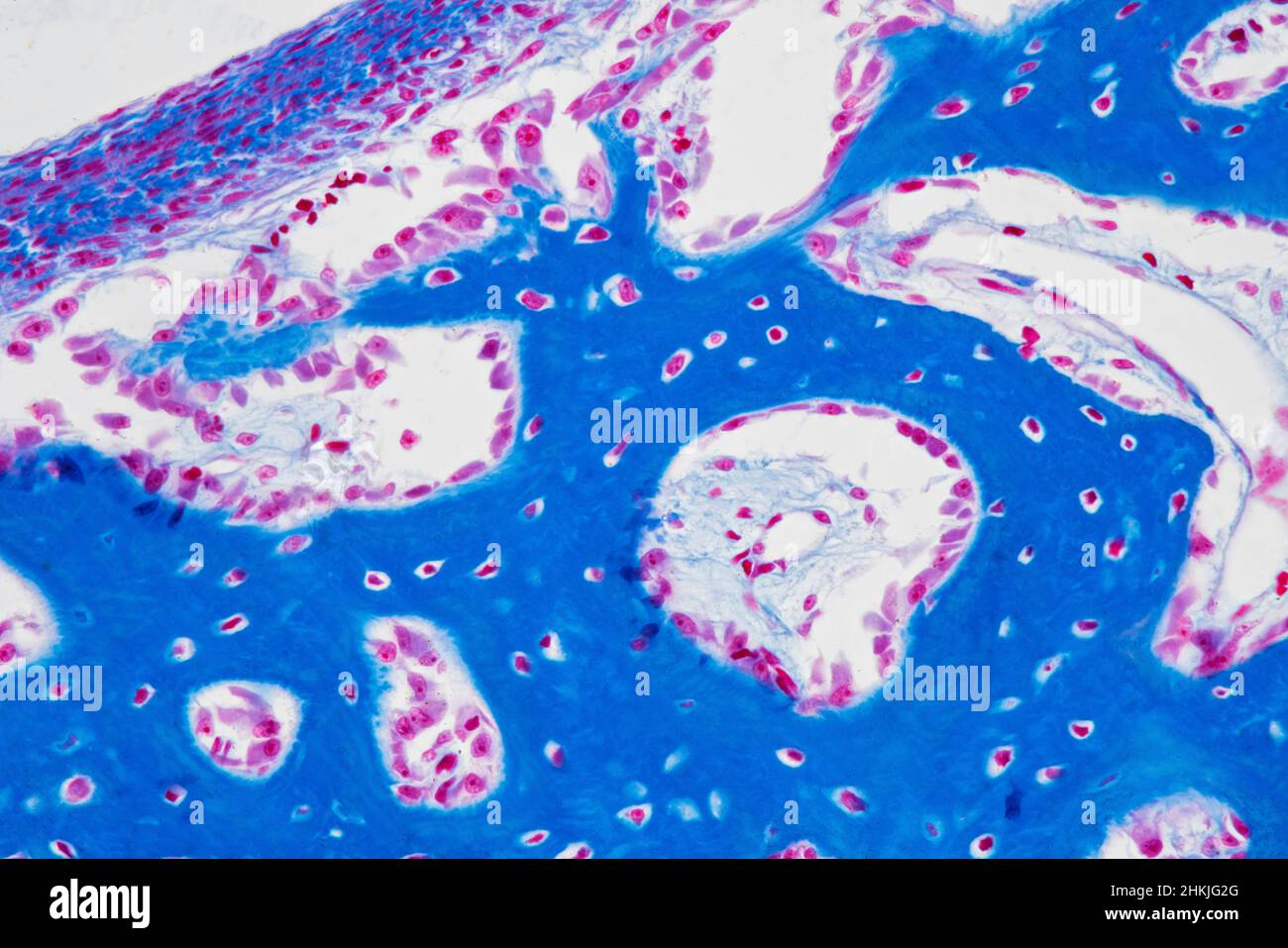 Bone formation, light micrograph Stock Photo - Alamy