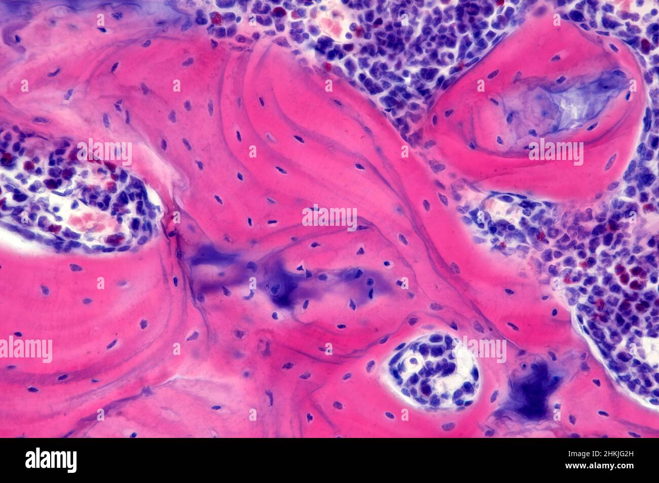 Bone tissue, light micrograph Stock Photo - Alamy