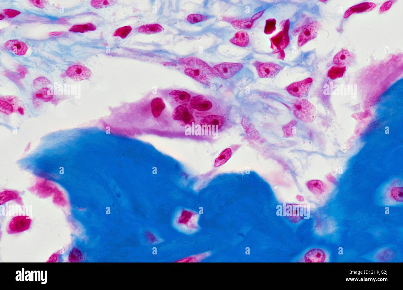 Bone formation, light micrograph Stock Photo - Alamy