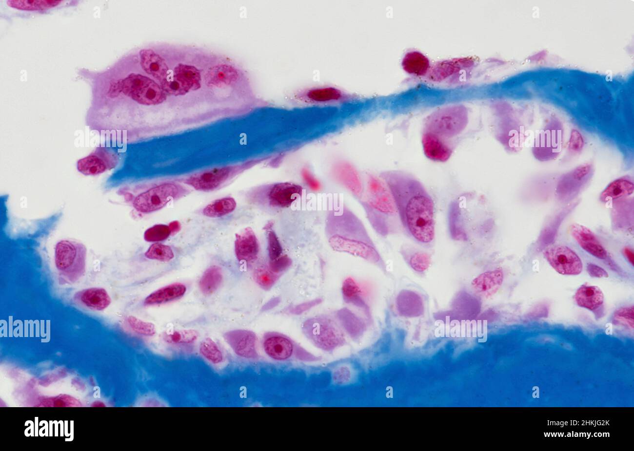 Bone formation, light micrograph Stock Photo - Alamy