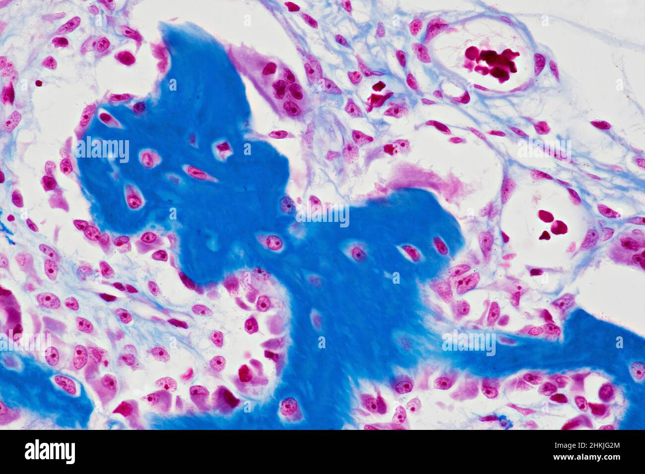 Bone formation, light micrograph Stock Photo - Alamy