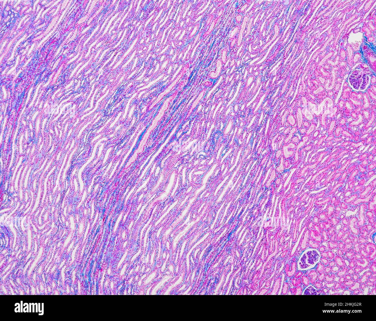 Kidney, light micrograph Stock Photo - Alamy
