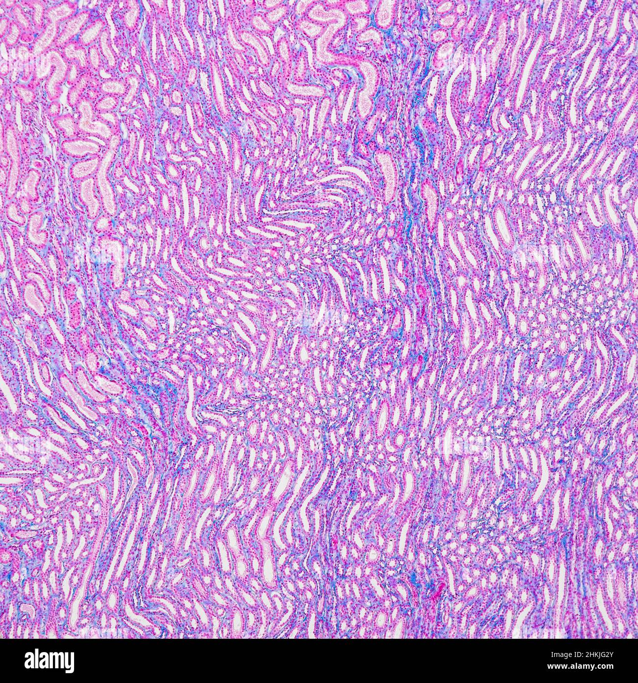 Kidney, light micrograph Stock Photo - Alamy