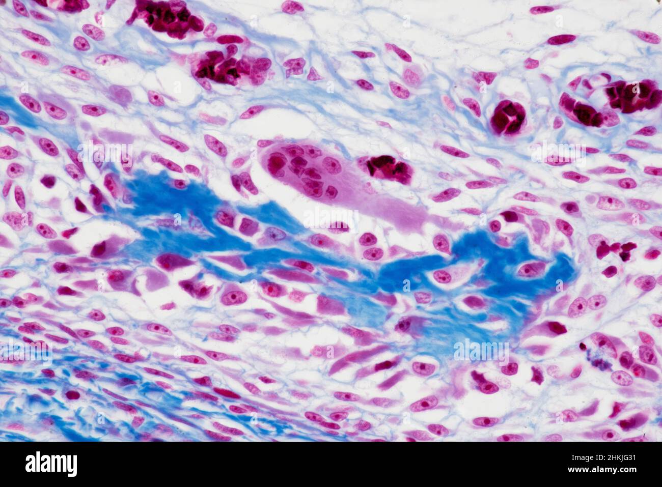 Bone formation, light micrograph Stock Photo - Alamy