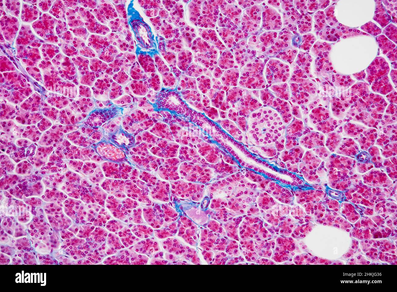 Pancreas, light micrograph Stock Photo - Alamy