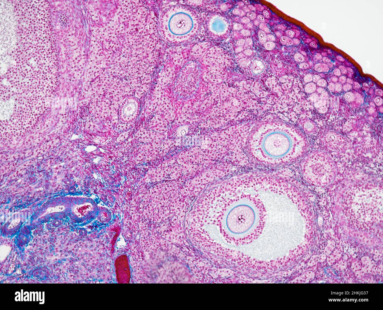 Ovarian follicles, light micrograph Stock Photo - Alamy