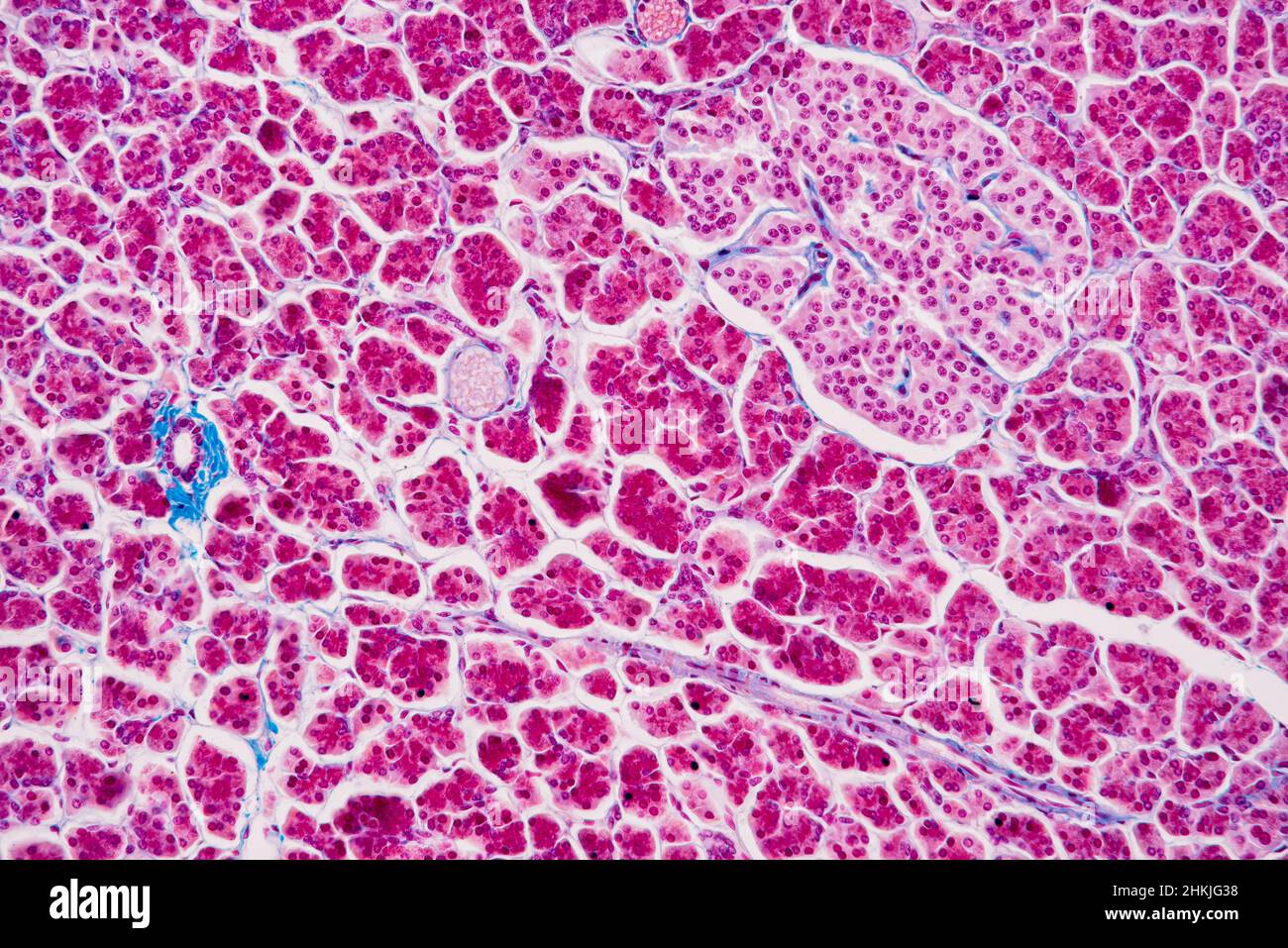 Pancreas, light micrograph Stock Photo - Alamy
