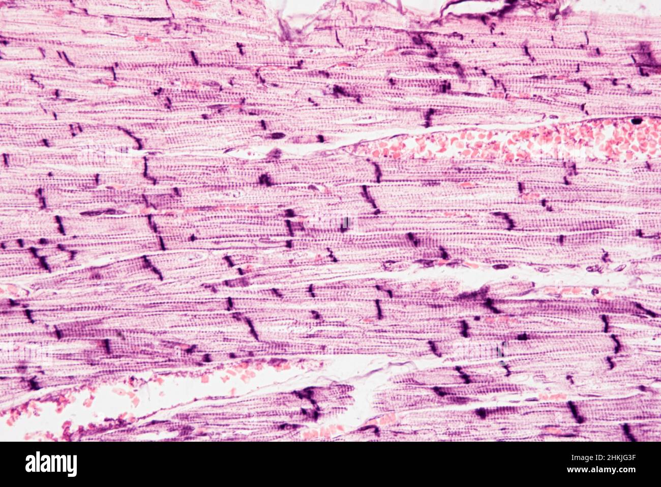 Heart muscle, light micrograph Stock Photo - Alamy